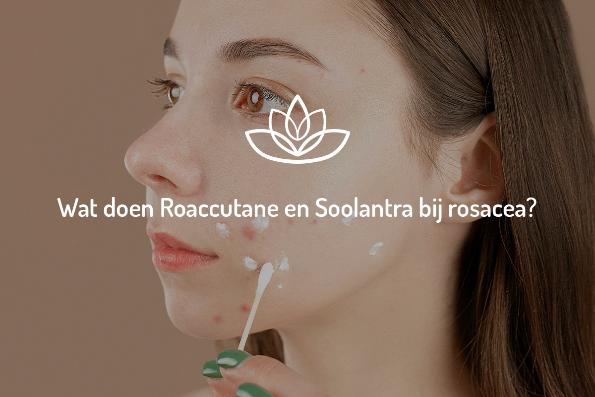 Wat doen Roaccutane en Soolantra bij rosacea? - Rositta Kliniek